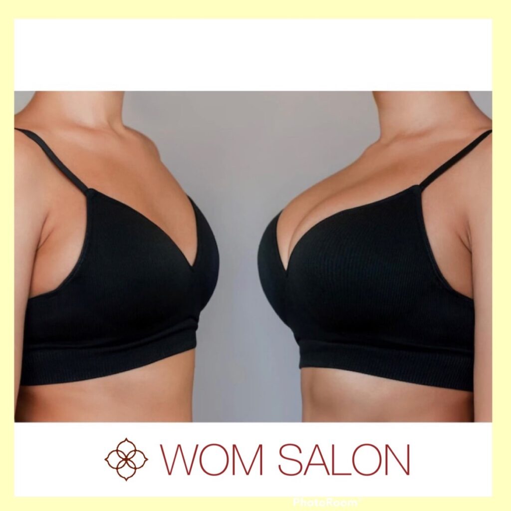 【インディバ】シリコンバック豊胸のケア ｜WOM SALON(ワムサロン)